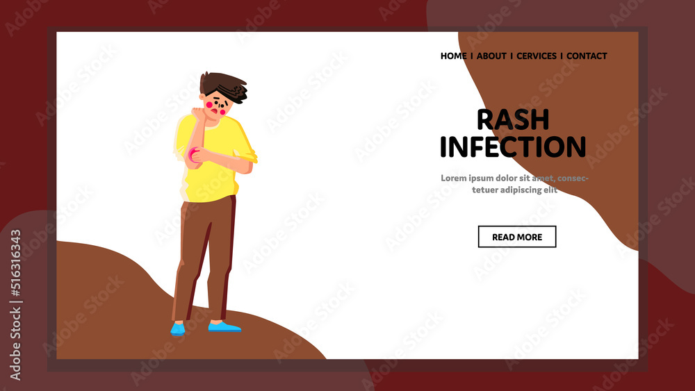 rash infection vector. monkeypox, skin virus, itchy disease rash ...