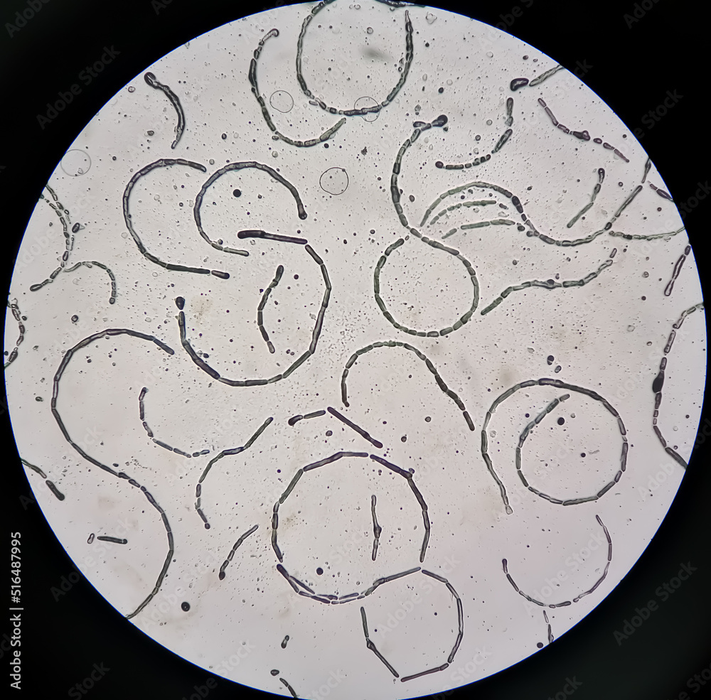 Microscopic image showing Hyphae of dermatophytes, skin scraping for ...