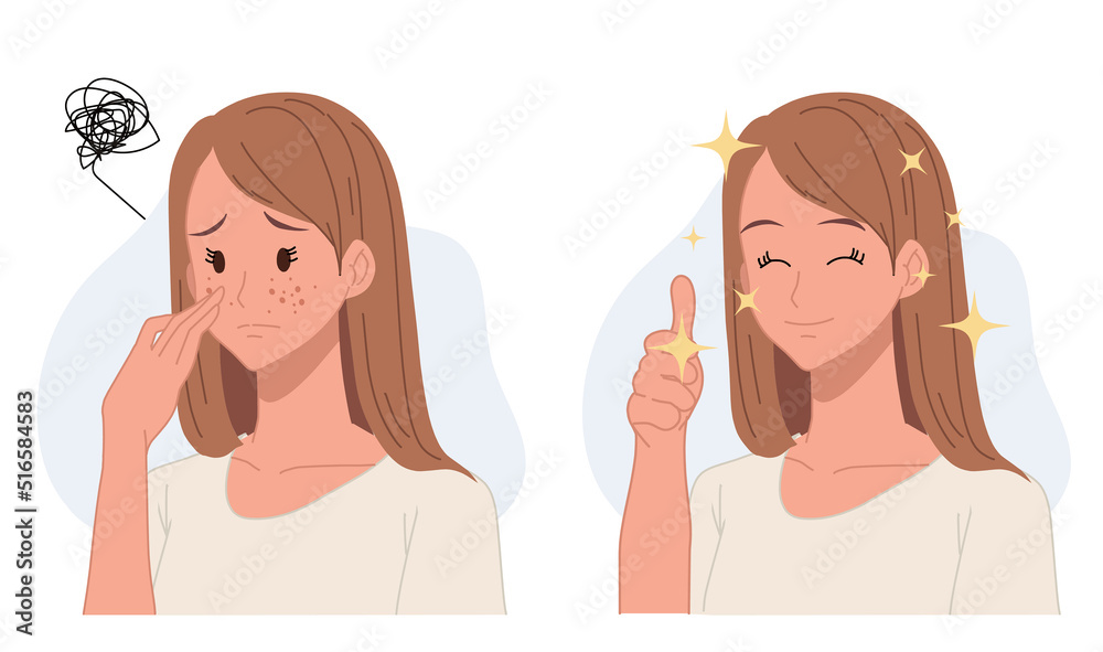 Skin care concept.woman,girl with acne.Before and after acne.Flat ...
