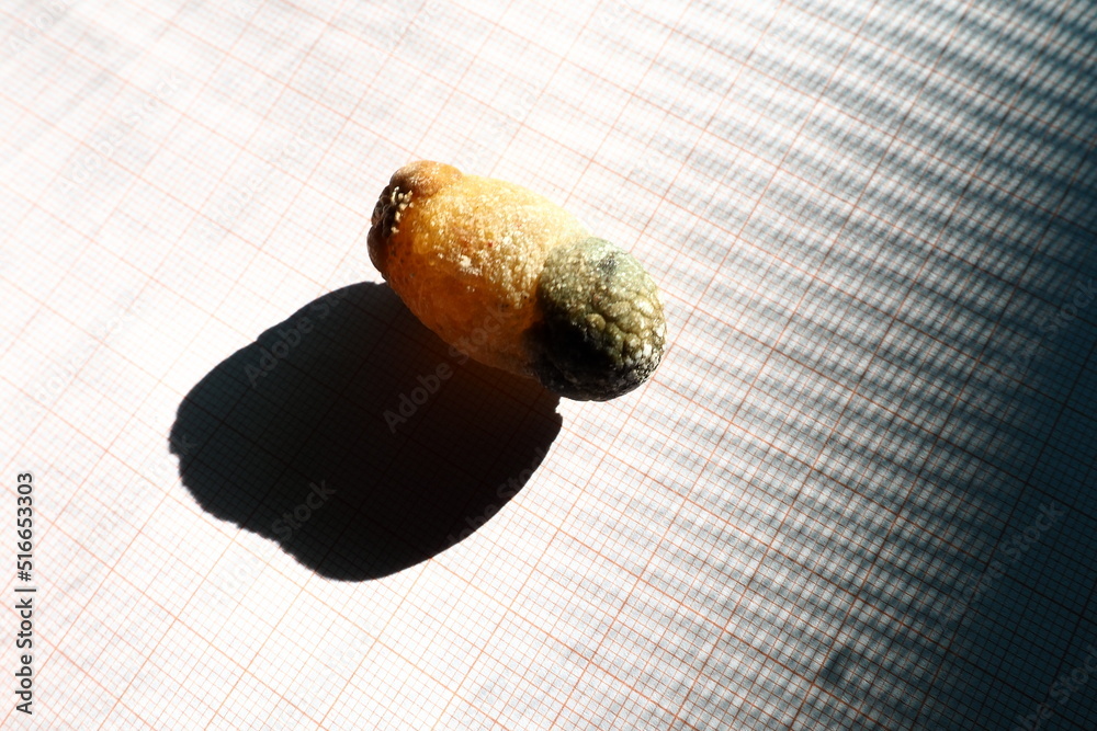 Foto de Gallstone disease, cholelithiasis - the formation of stones ...