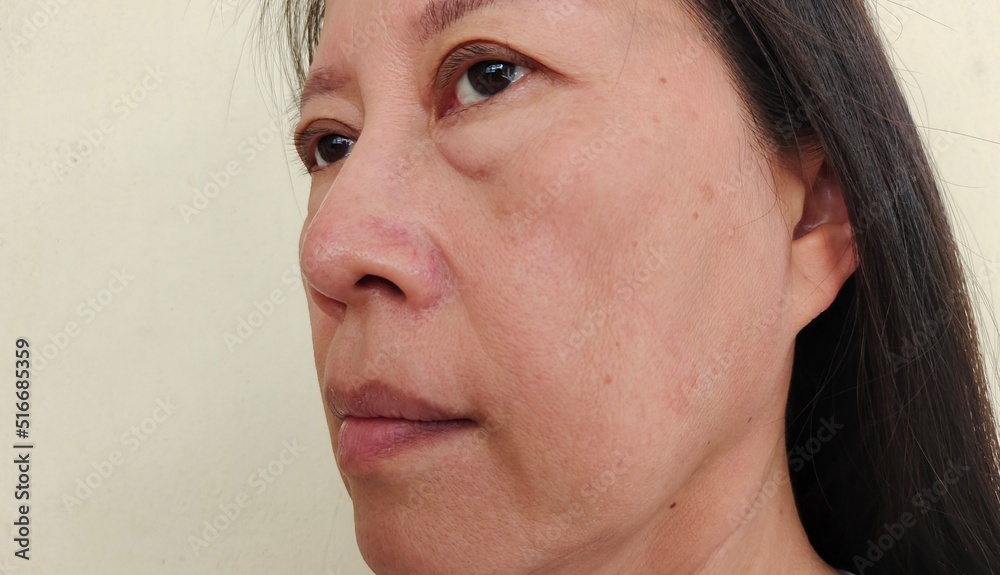 Portrait showing the Flabby and sagging beside the mouth, wrinkles and ...