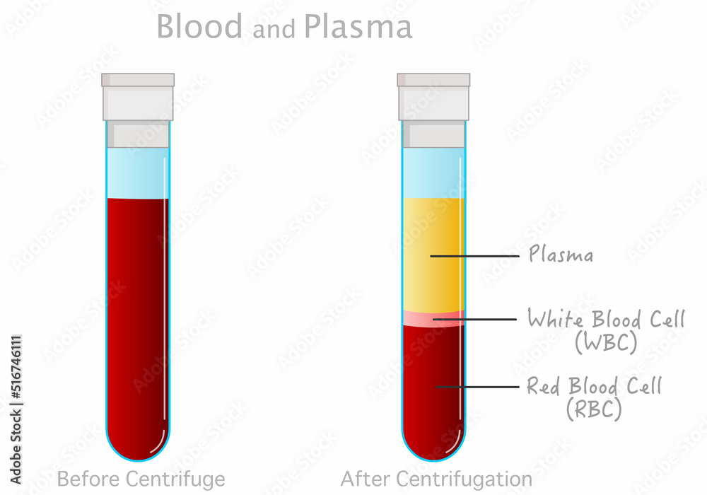 Blood Plasma Anatomy White Red Blood Cell Human Platelet Before Blood Plasma Anatomy White Red Blood Cell Human Platelet Before