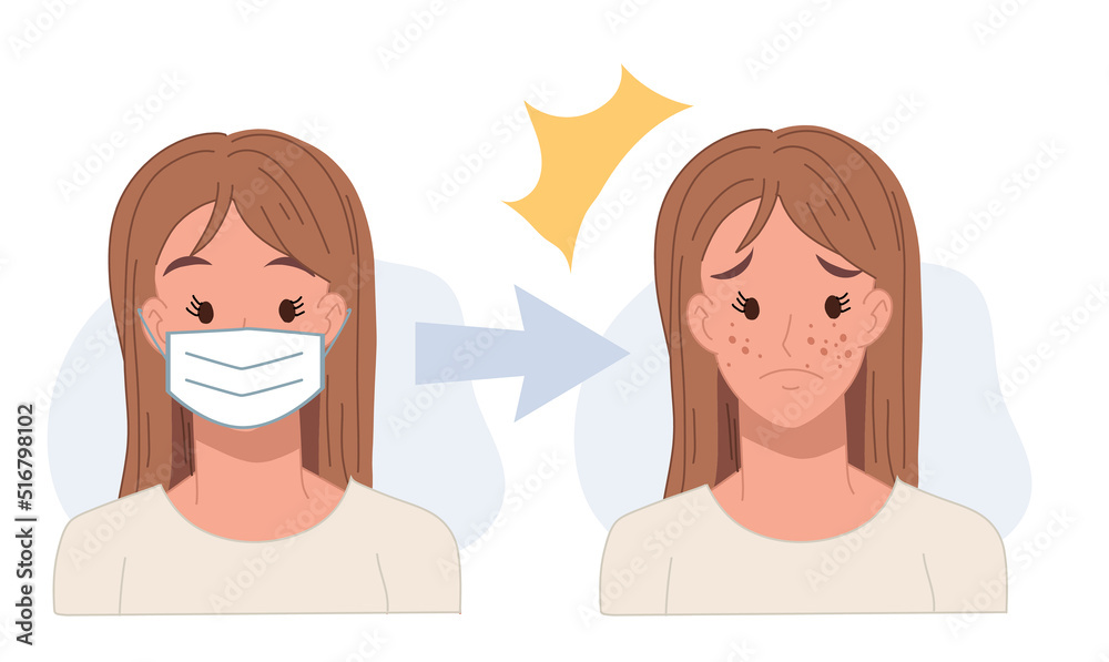 Acne caused wearing face mask.acne concept.pimples. skin problems .Flat ...