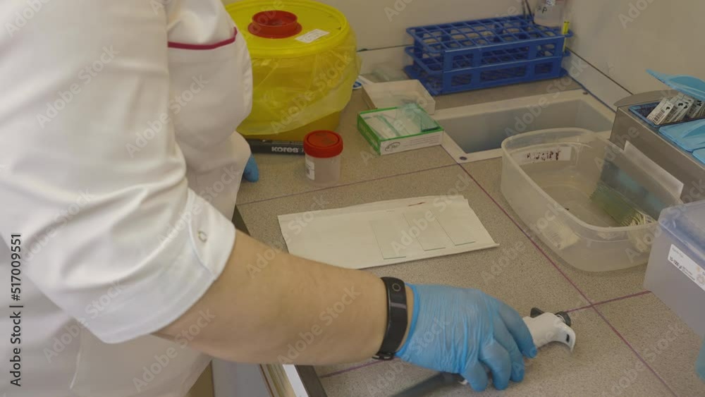 Medical Scientist Marks Microscope Slides For Blood Test. Doctor Works ...