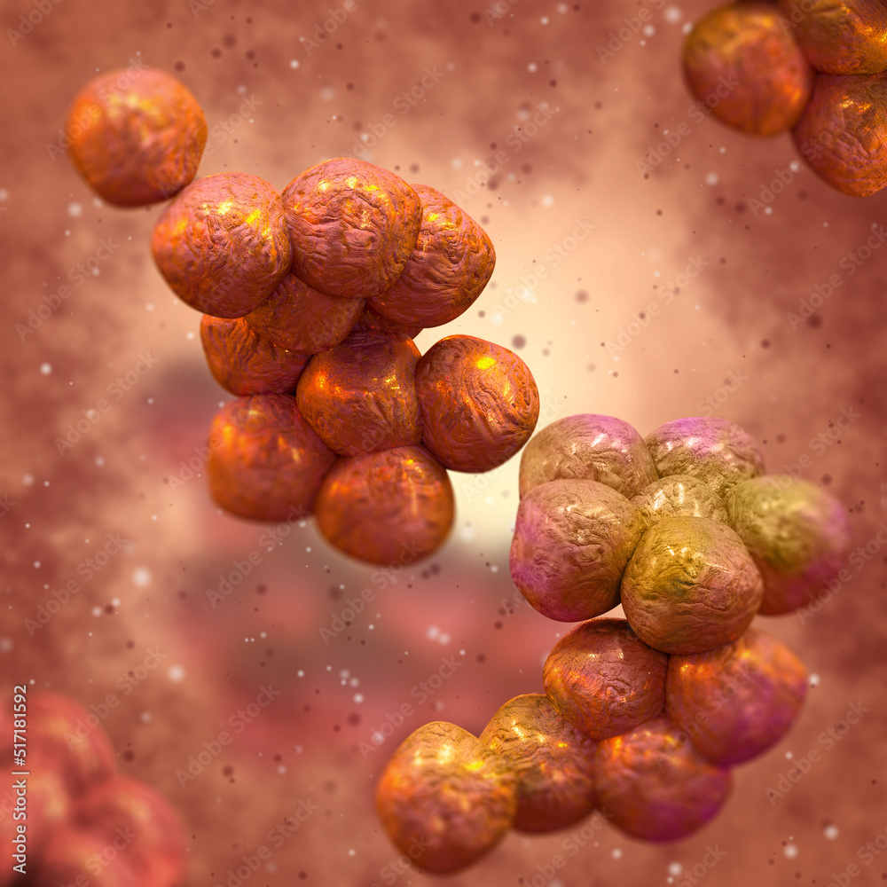 Medical background, Staphylococcus aureus, a type of spherical gram ...