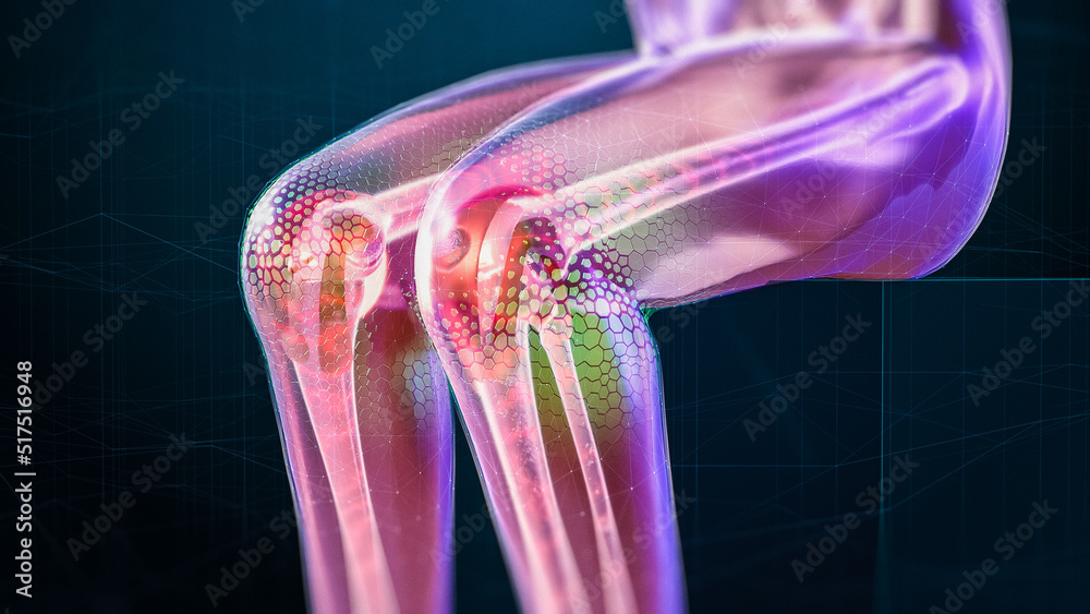 VFX Joint and Knee Pain Virtual Reality Presentation Render. Digitally ...