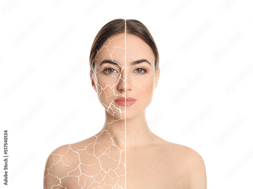 Collage with photos of woman having dry skin problem before and after ...