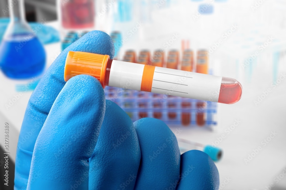 Blood sample of patient for test in laboratory. doctor with Blood tube ...