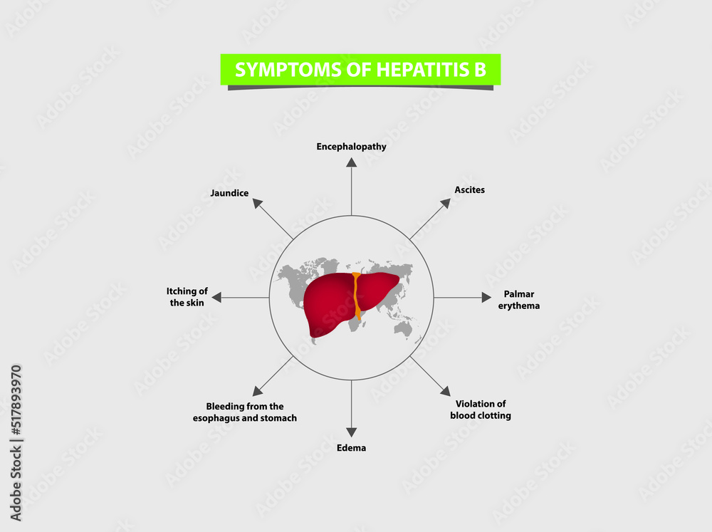 Symptoms of hepatitis B. Liver with world map. World Hepatitis Day ...