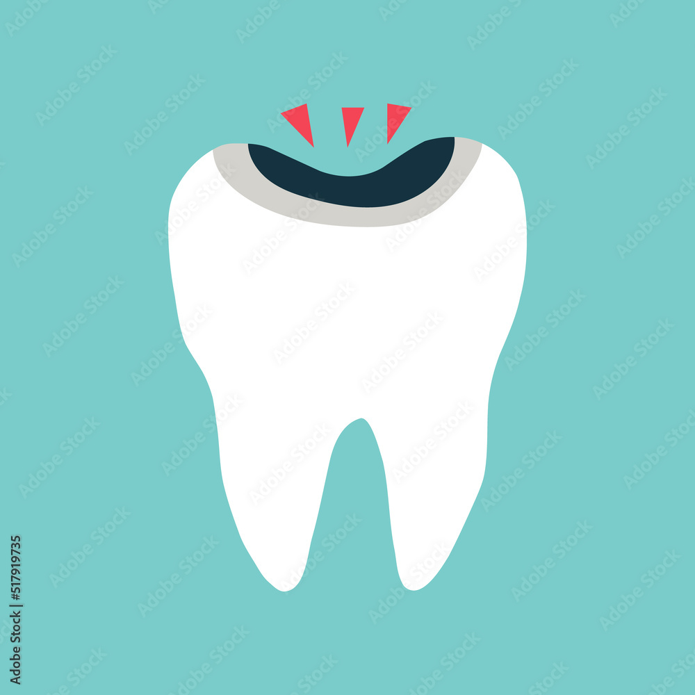 Sore tooth with black tooth decay. Isolated clipart in doodle, cartoon ...