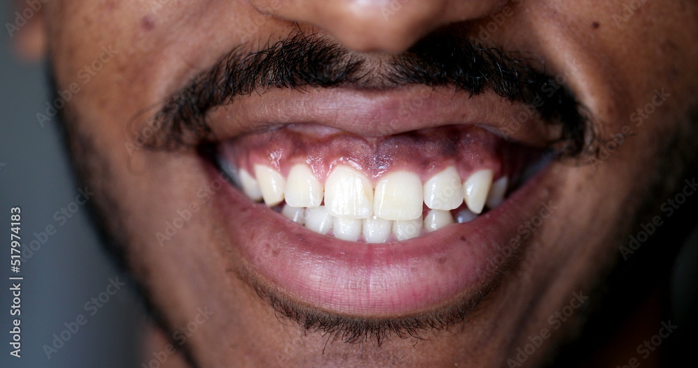 Lips macro close-up, black African man smiling Stock Photo | Adobe Stock