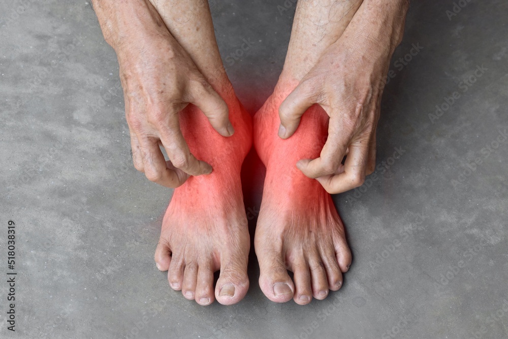 Asian man scratching his foot. Concept of itchy skin diseases such as ...