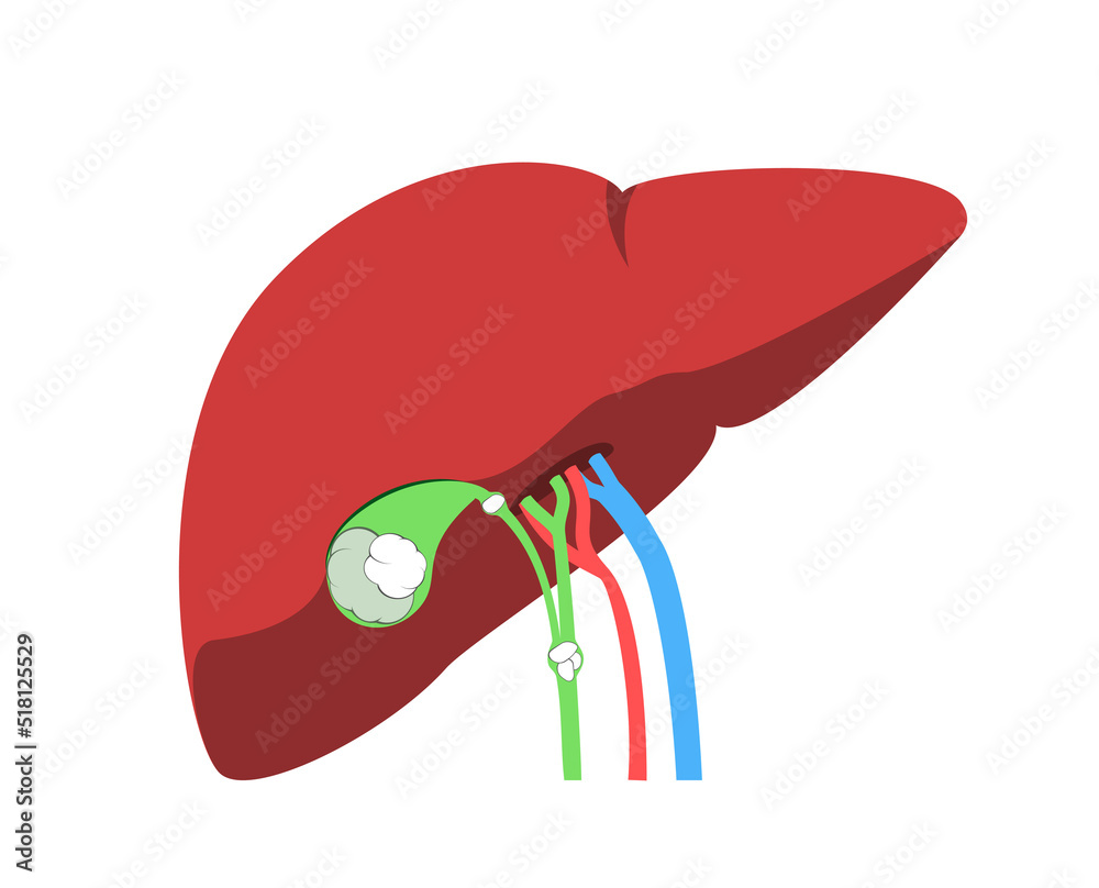 Vetor de Medical illustration of liver, gallbladder, bile ducts ...