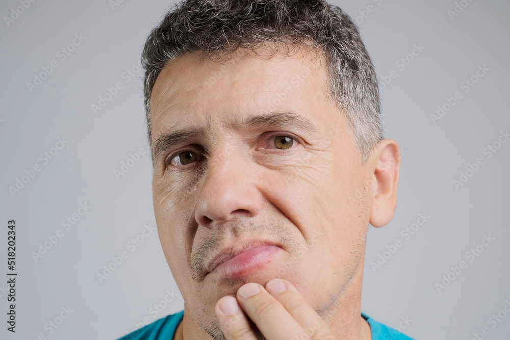 Allergic reaction to a bee sting. An unshaven man was stung by a bee ...