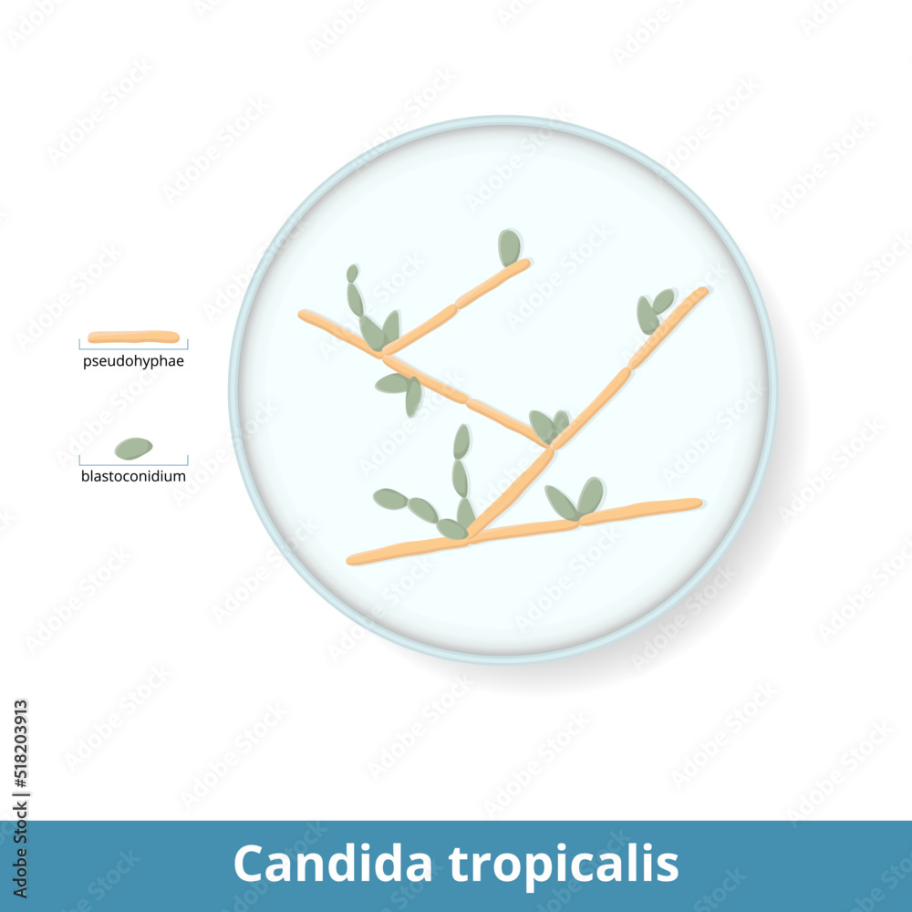Candida tropicalis. Species of yeast in the genus Candida. A common ...