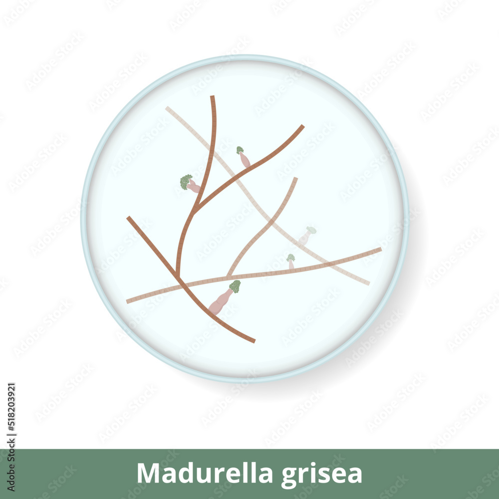 Madurella Grisea