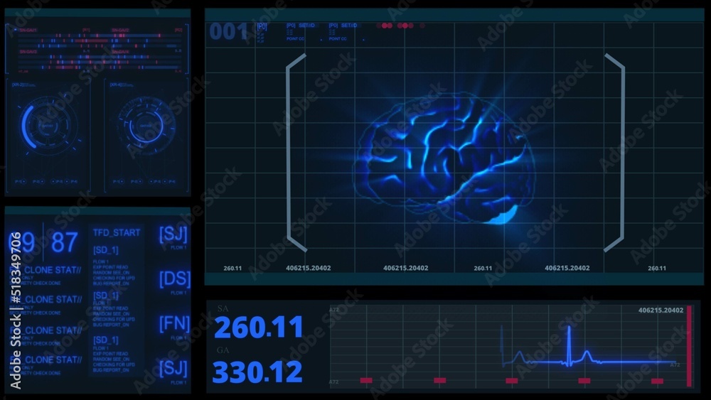 Human brain scan. Futuristic medical user interface with HUD and ...