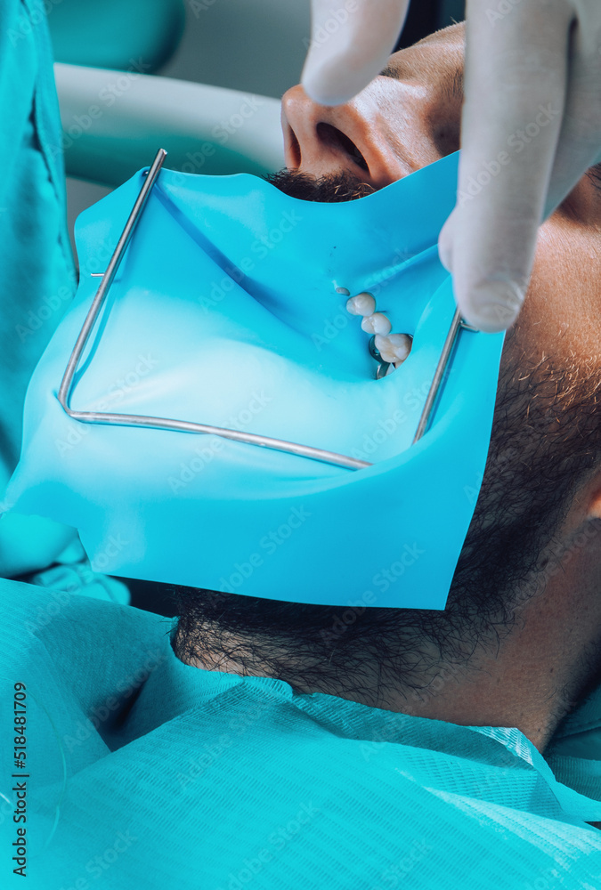 Detail of patient teeth during dental surgery Stock Photo | Adobe Stock