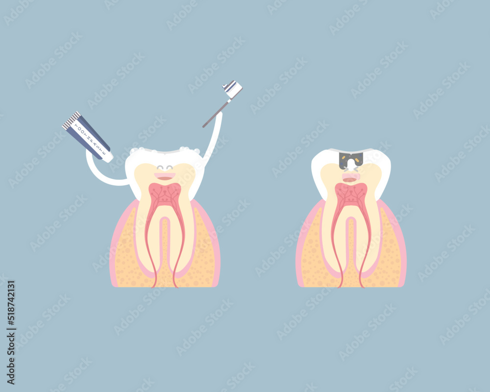 dental teeth care with tooth decay, cavity, caries, internal organs ...