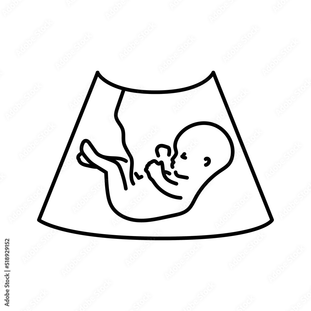 Ultrasound embryo color line illustration Stock Vector | Adobe Stock