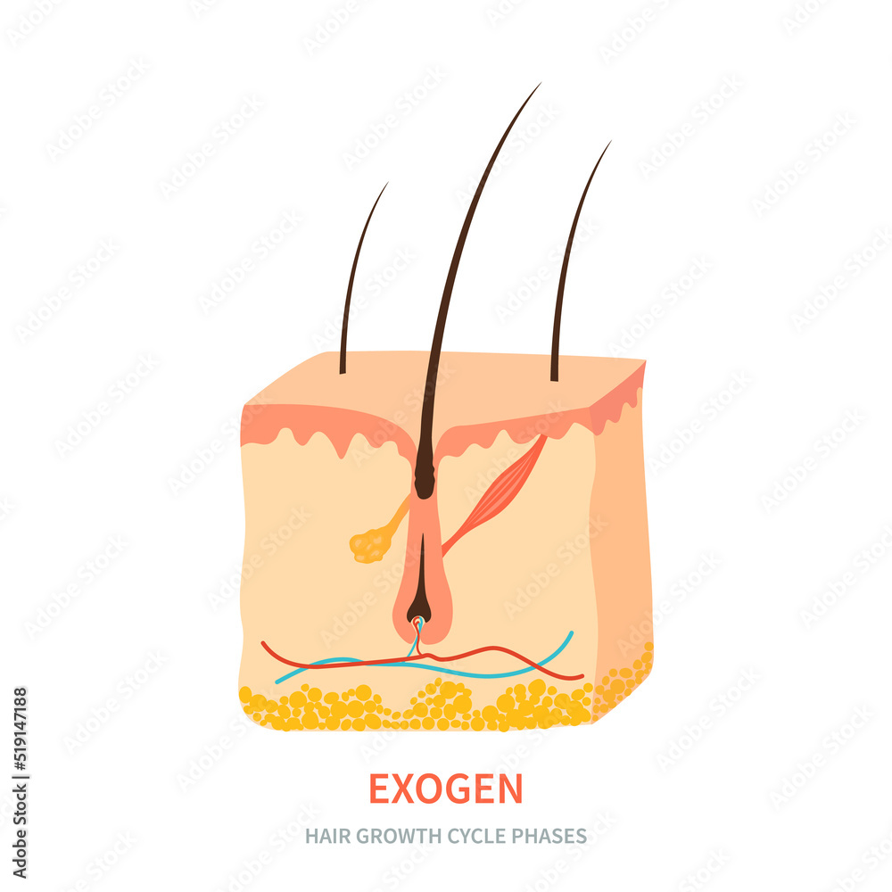 Hair Follicle In Exogen Phase Shown In Skin Cross Section Hair Growth