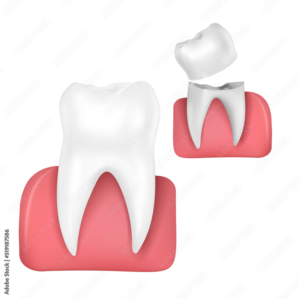 Tooth anatomy medical banner. 3D Vector infographics. Dental poster ...