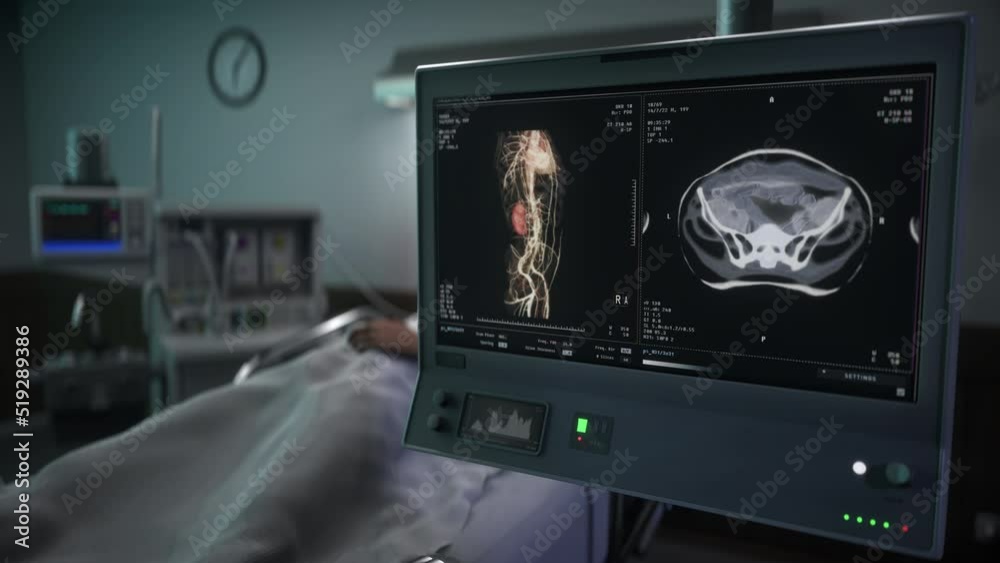 Scanning the injured organs of the emergency patient at the healthcare ...
