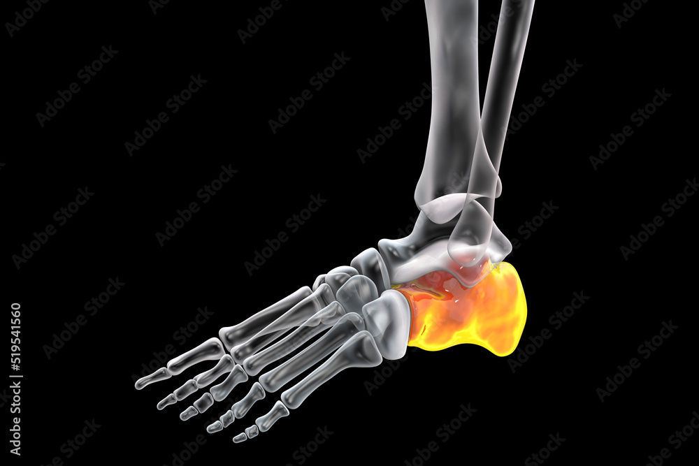 Human foot anatomy. Calcaneus bone of the foot Stock Illustration ...