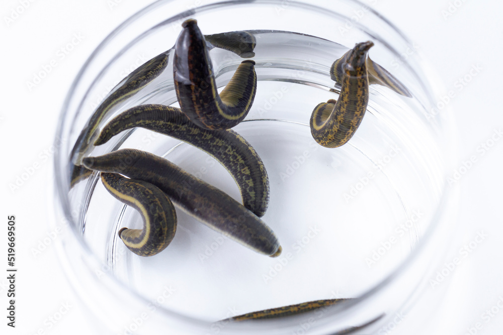 well-fed, full of blood medical leeches in a glass jar after the ...