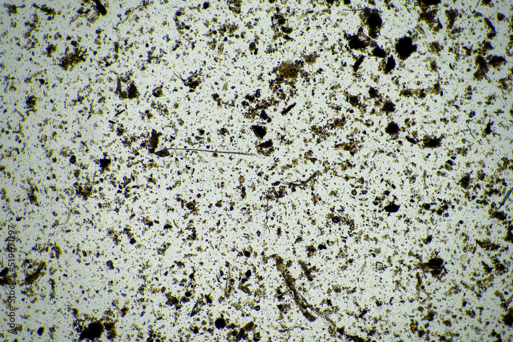soil under the microscope, foot and mouth disease, australia Stock ...