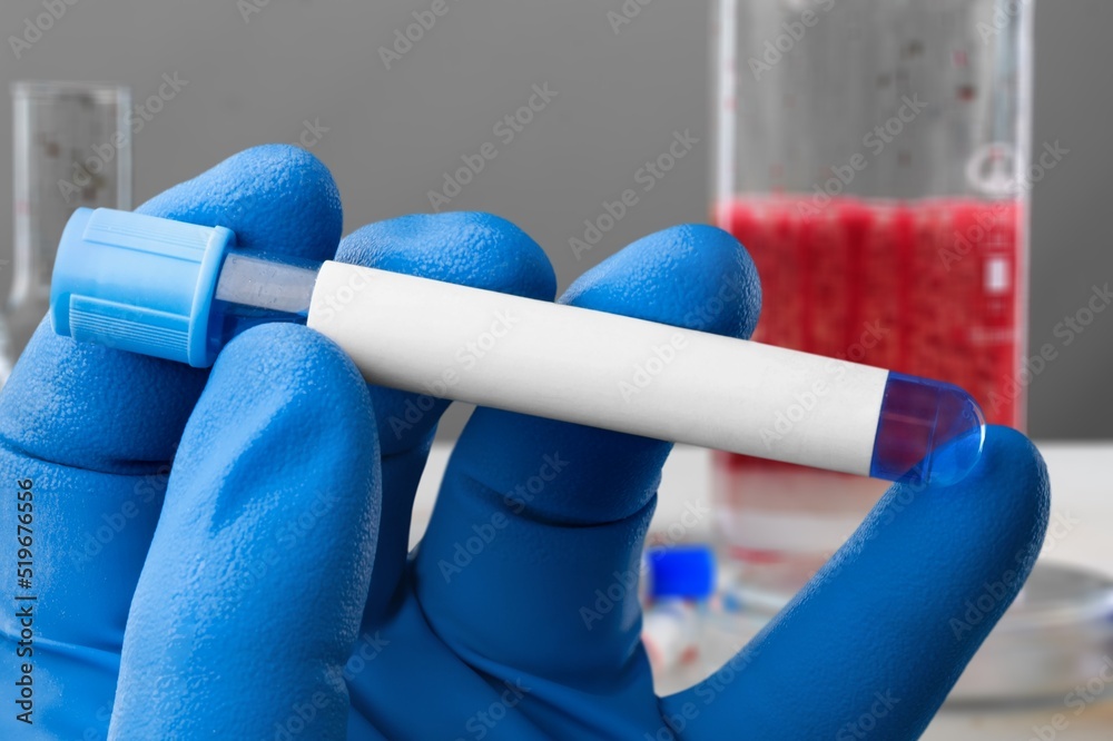 Blood sample of patient for complete screening test in laboratory ...