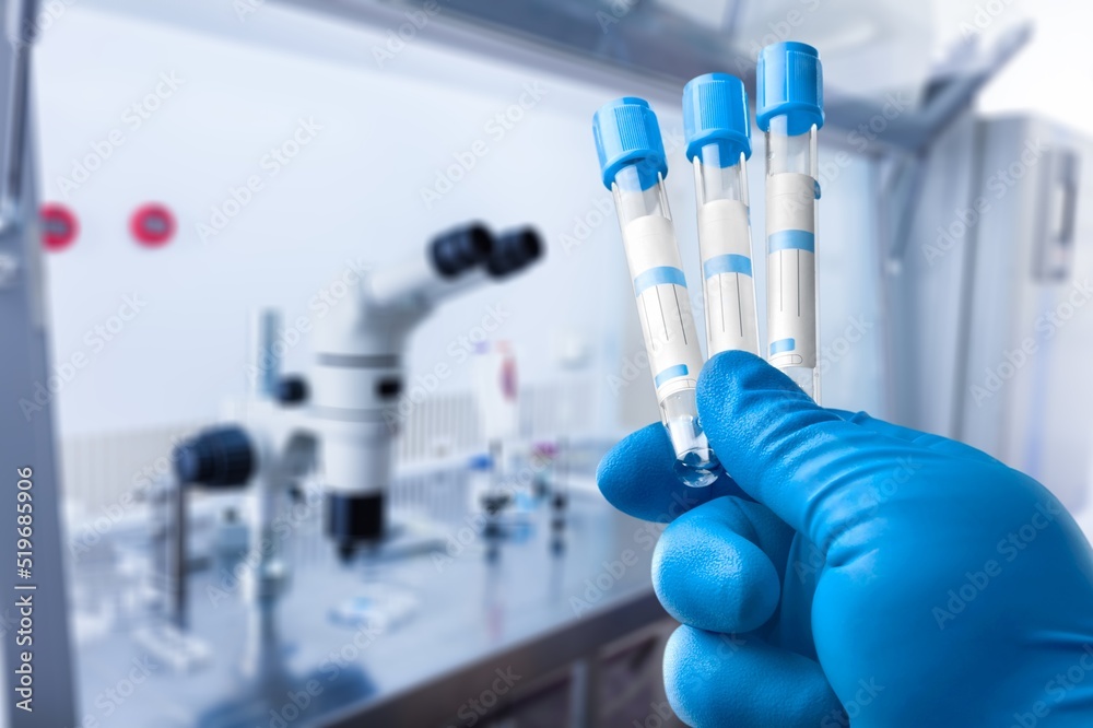 Blood sample tube for virus test. It is also known as the Moneypox ...
