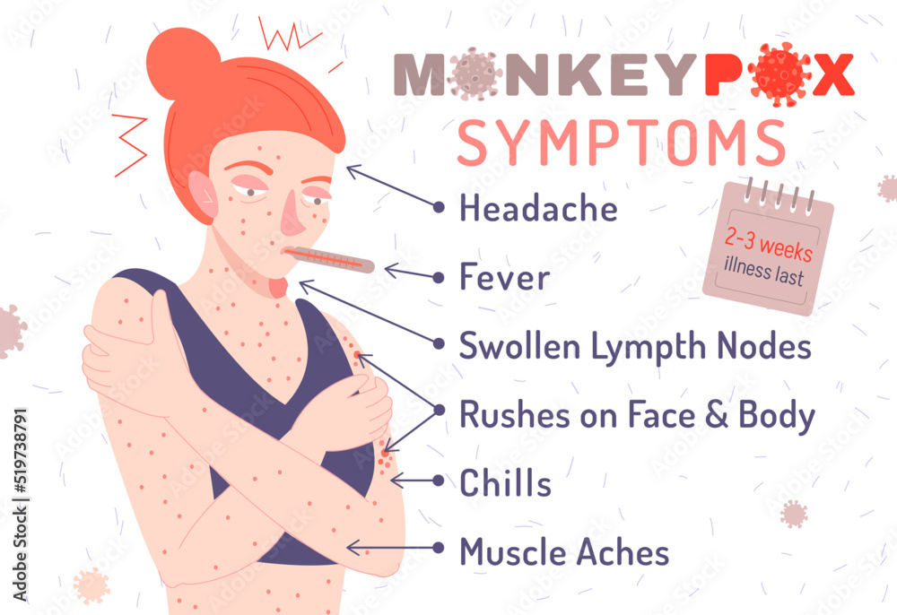 Monkeypox virus infographics. Symptoms and useful information. Stock ...