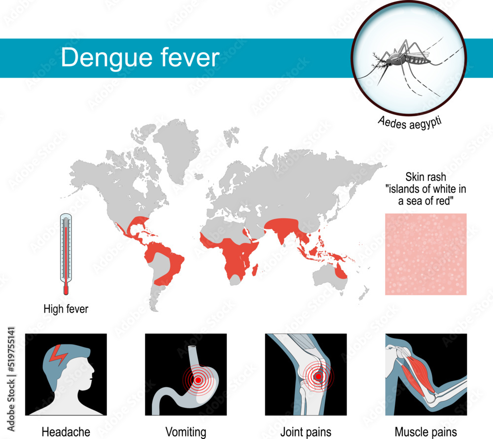 Dengue fever symptoms. infographics and awareness poster with map Stock ...