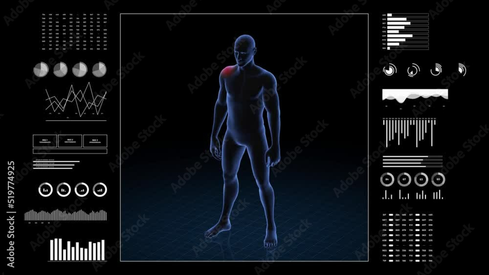 Man with shoulder pathology. 3d body of boy. Rotating animation and ...