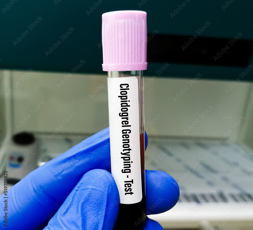 Clopidogrel PCR Genotyping test. CYP2C19 gene testing. Polymerase chain ...