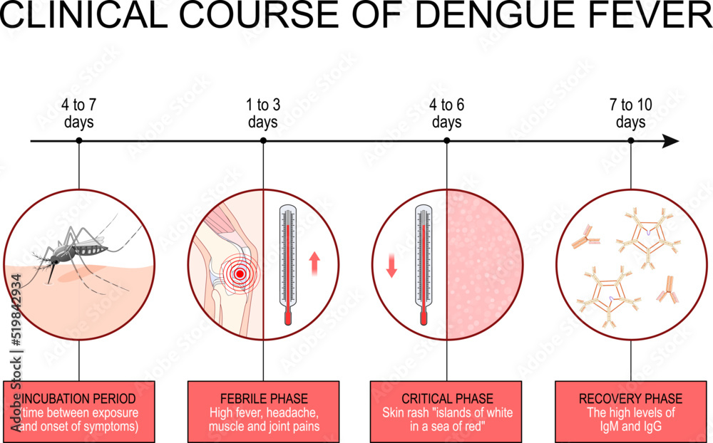 dengue fever. Clinical course infographics. Stock Vector | Adobe Stock
