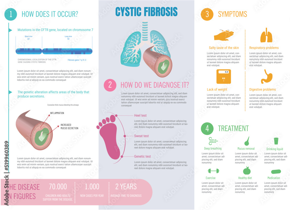 Infographic about cystic fibrosis disease, what is its origin, symptoms ...