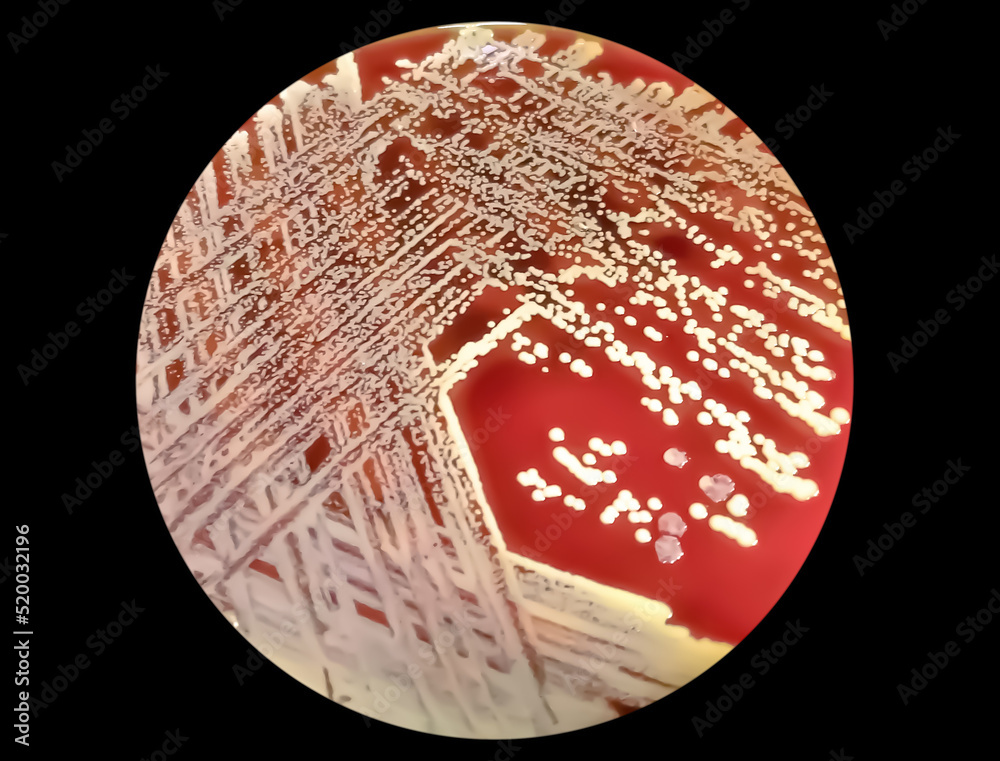 Staphylococcus aureus: Gram-positive, to Gram-variable, nonmotile ...