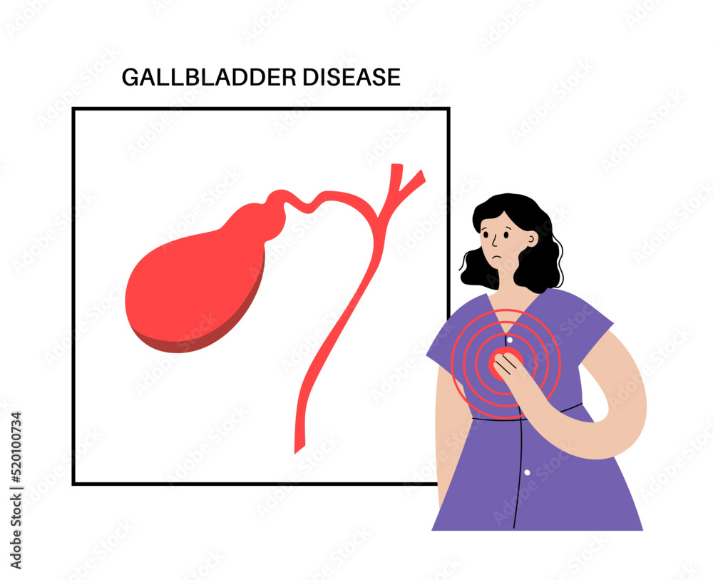 gallbladder disease poster Stock Vector | Adobe Stock