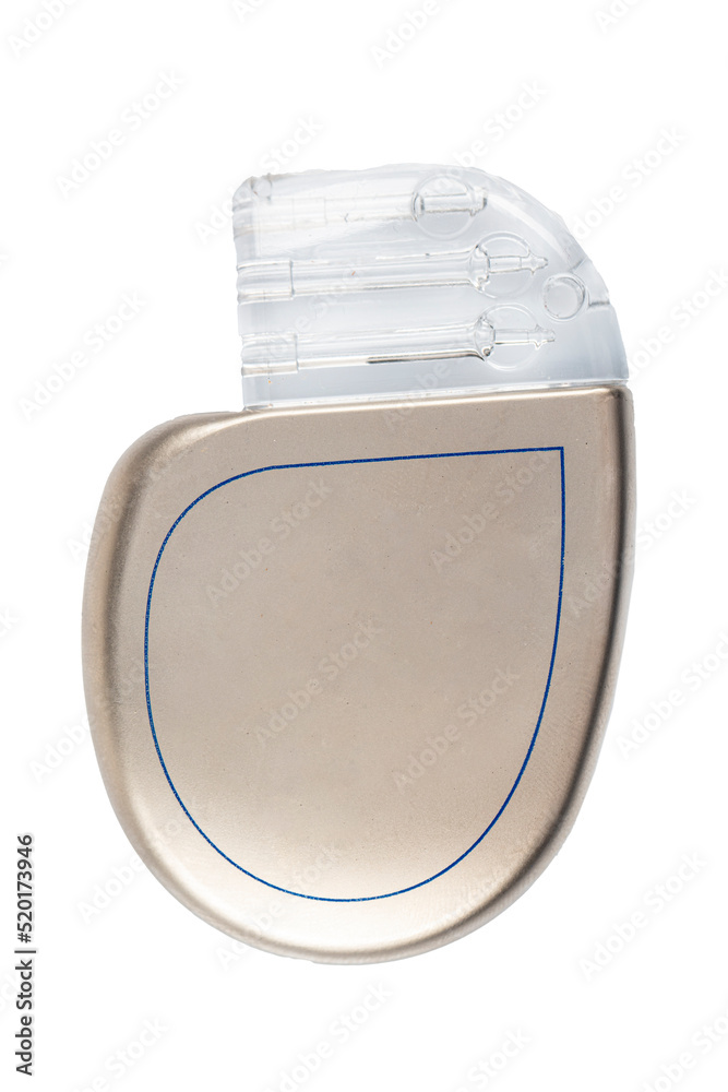 Pacemaker isolated on a white background. Heart battery. Close-up of ...