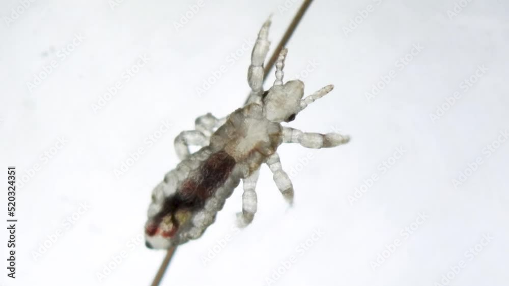 Detail look on head louse on a human hair with movement in her internal ...