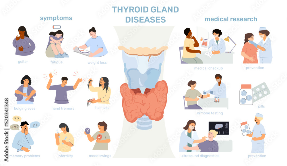 Thyroid Gland Diseases Set Stock Vector | Adobe Stock