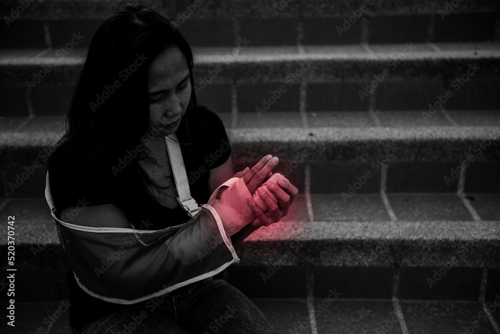 A beautiful Asian girl broke her arm and splinted,Woman accidentally ...