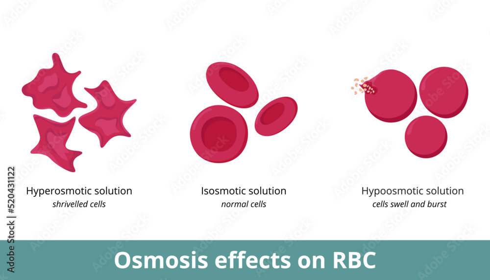 Osmosis effect on red blood cells. Depending on solution concentration ...