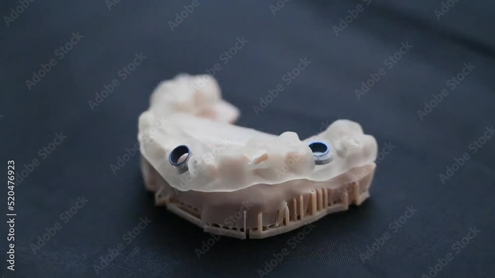 Surgical Guide Implant Systems Stock Video | Adobe Stock