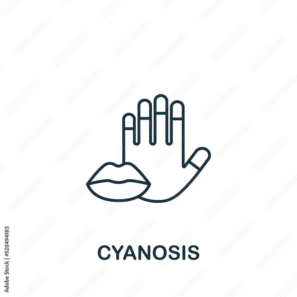 Cyanosis icon. Monochrome simple Allergy icon for templates, web design ...