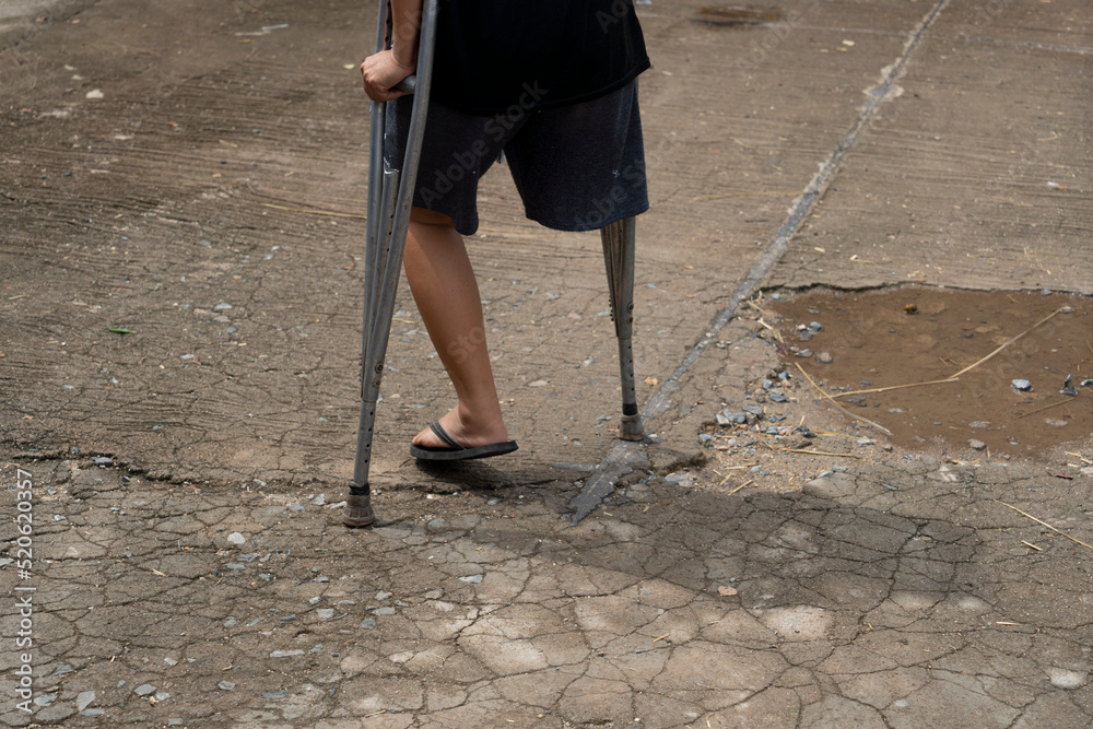 Walking on crutches due to foot disability, concept for physical pain ...