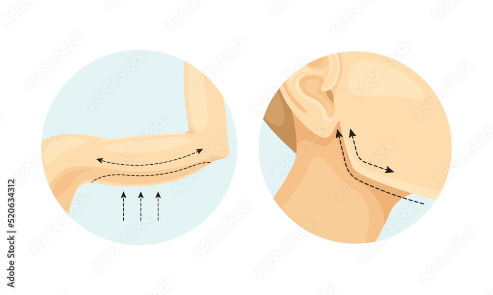 Plastic Surgery for Arms and Face as Restoration and Reconstruction of ...