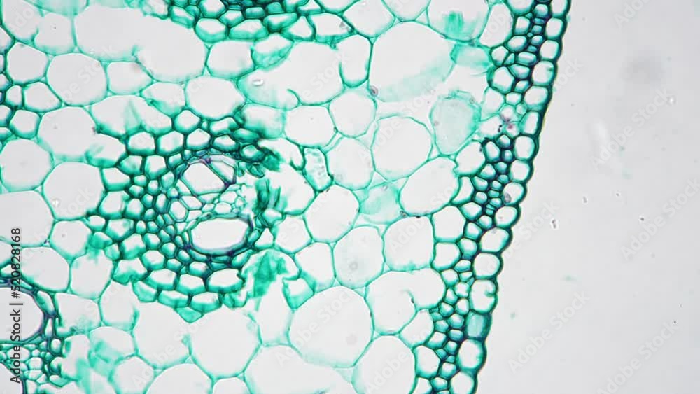 Monocotyledon Stem in transversal section cut under the microscope 200x ... Monocotyledon Stem in transversal section cut under the microscope 200x ...
